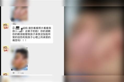 校方回应“男生被女同学泼热水烫伤”：一直在沟通解决