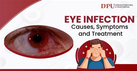 Eye Infection Causes Symptoms And Treatments