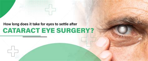 Eye Irritation After Cataract Surgery Symptoms