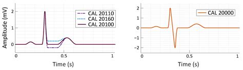 Impact Of Mother Wavelet Choice On Fast Wavelet Transform Performances For Integrated St Segment