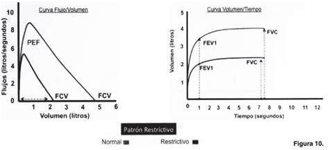 ¿cómo Se Realiza La Interpretación De Una Espirometría Kineed