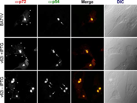 Immunofluorescence Microscopy Analysis Of The Subcellular Localization Download Scientific