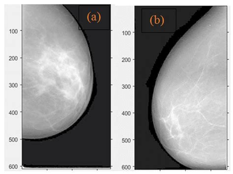 Log Transform Images Download Scientific Diagram