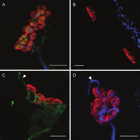 Maximum Z Projections Of Confocal Image Stacks Showing Examples Of A