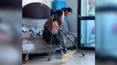 Dak Ampute Life With Prosthesis And Crutches Amputados Amputasi