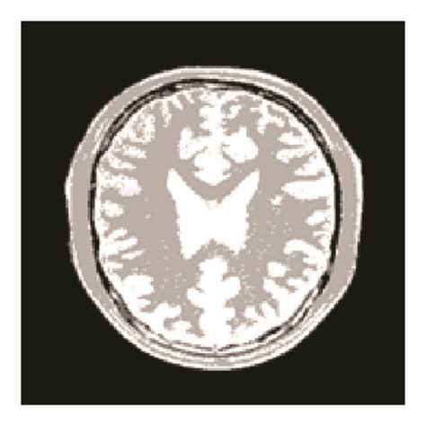segmentation results obtained by otsu download scientific diagram