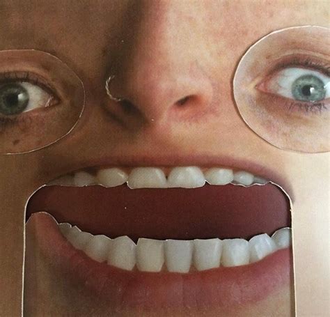 Abap Sap Abapfox Aprenda Abap Definitivamente