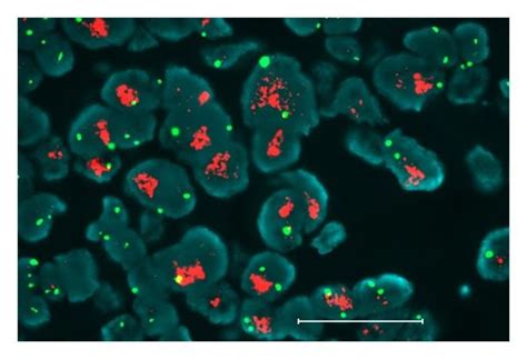 Accurate Her2 Testing By Qds Ihc A Specimens With Difference Her2 Download Scientific