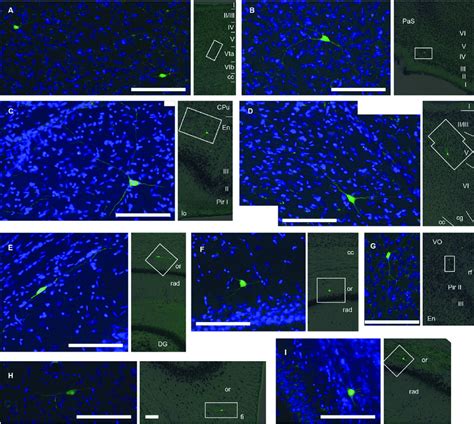 Input Cells From Cortex In Each Pair Of Panels Gfp Appears On Dapi