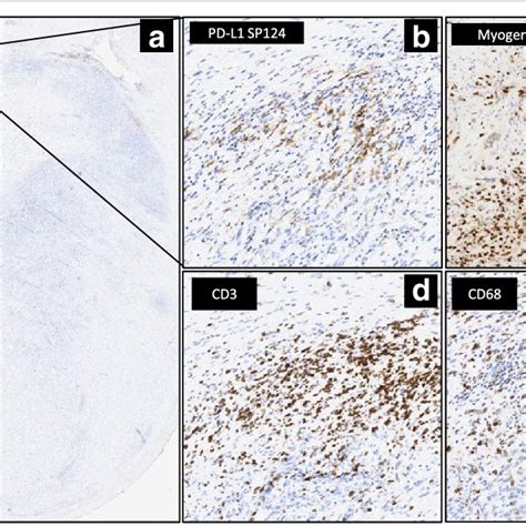 Pd L1 Expression In Rms Cell Lines A Expression Of Pd L1 By