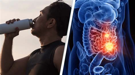 Experts Discover Daily Drink Can Cut Bowel Cancer Risk By A Significant