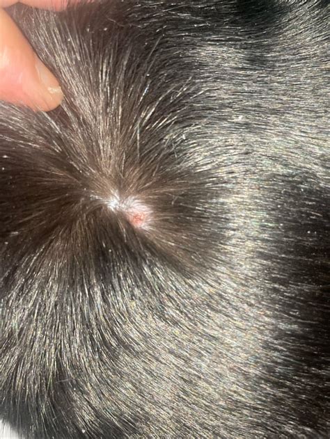 I Found This Pimple Like Bump On My Cats Back Anyone Have A Clue On