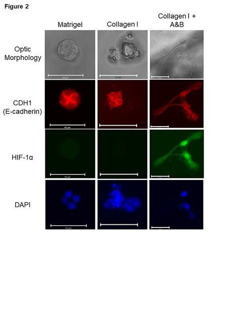 Gerd Induced Alterations In Hydrogen Sulfide Signaling As The