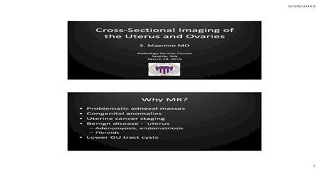 Download Pdf Cross Sectional Imaging Of The Uterus And Ovaries