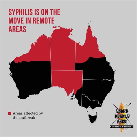 Syphilis Infographics