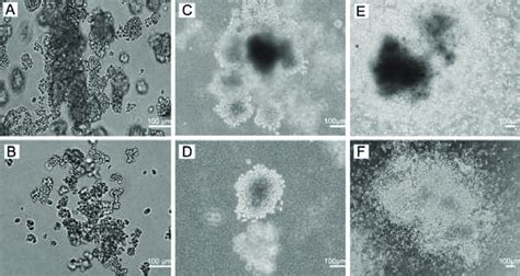 Cfu Gemm Bfu E Cfu Gm Colonies Obtained From E12 5 Placenta And Download Scientific Diagram
