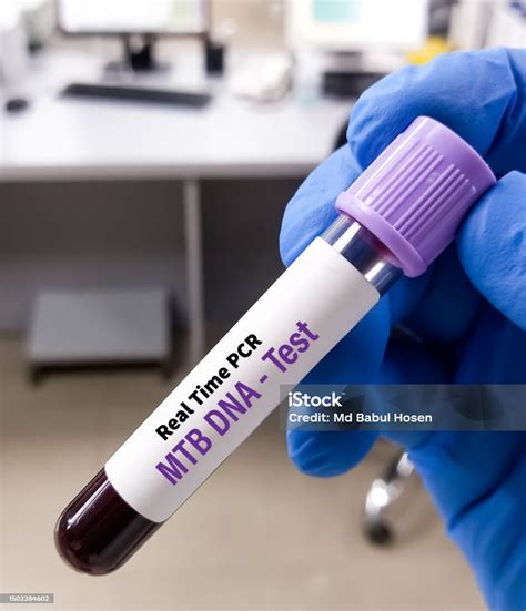 결핵 진단을 위해 Pcr Mtb Dna 검사를 위해 혈액 샘플을 들고 있는 과학자 Pcr 장치에 대한 스톡 사진 및 기타 이미지