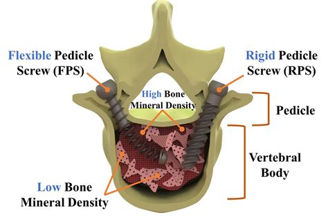 Towards Biomechanical Evaluation Of A Transformative Additively