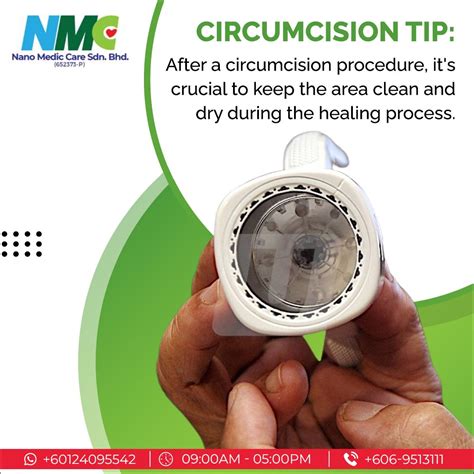 Circumcision Foreskin Hisbodyhischoice Facts Itsaboy