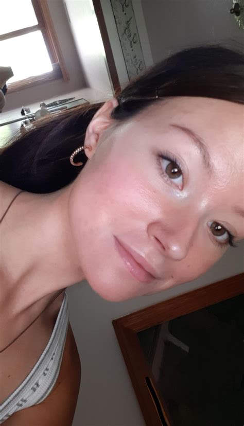 One Month Down On Accutane 60mgs And Can Say Im Pretty Impressed