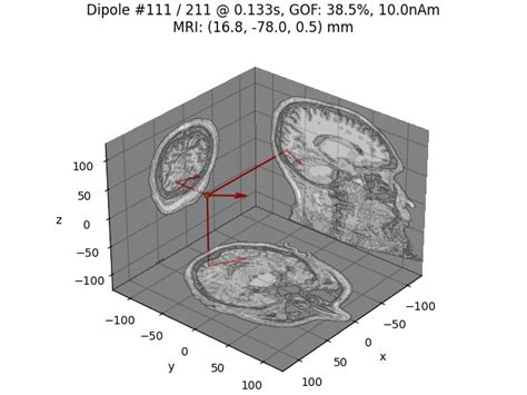 Compute A Sparse Inverse Solution Using The Gamma Map Empirical Bayesian Method — Mne 1110