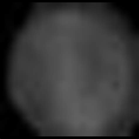 Ecoli Classification Dataset By Vsnehit999