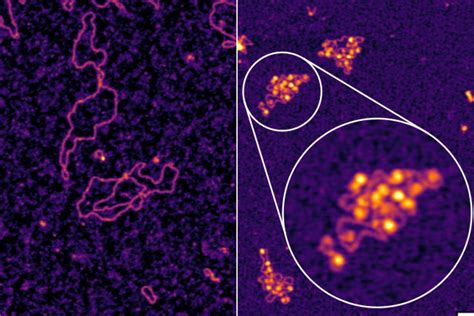 Decades Old Hepatitis B Mystery Solved New Treatment On The Horizon