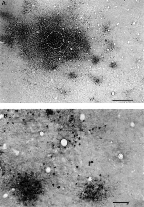 2 Tangential View Through Layer 3 Of Intrinsic Connections In Macaque Download Scientific