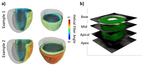A Examples Of Synthetic Fiber Structures With Helical Fiber Angle