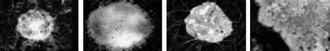 Figure 1 From Automatic Segmentation Of Dermoscopy Images Using
