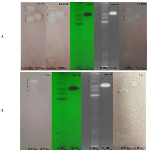 Chicory Extracts And Sesquiterpene Lactones Show Potent Activity