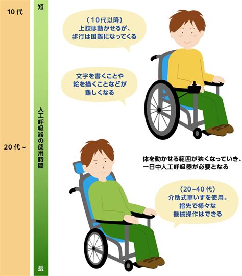 デュシェンヌ型筋ジストロフィーの症状 Dmdを知る 日本新薬株式会社