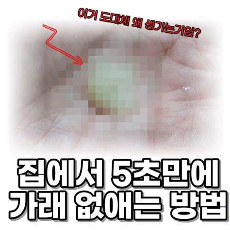 단 3분만에 가래 빼고 없애는 방법 이제 그만 시원해지자 원인 좋은 음식