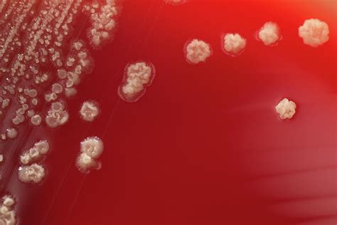 Candida Albicans Fungal Culture Photograph By Science Photo Library
