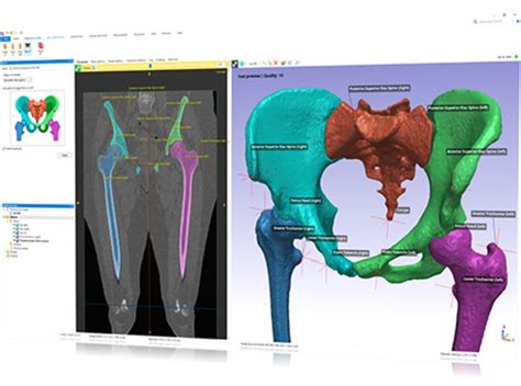 Planning Software Module Simpleware Automated Solution Synopsys