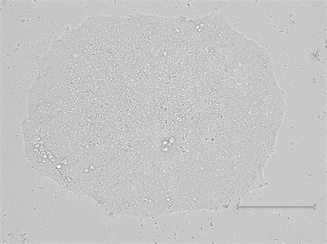 Recombinant Human Vitronectin Protein Qk120 Qkine
