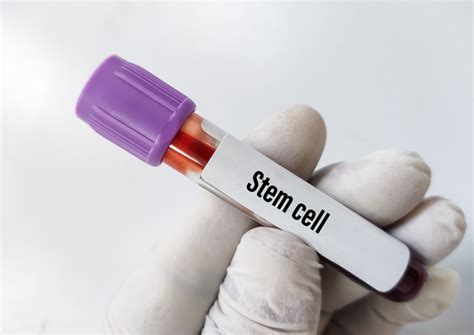 Terapi Stem Cell Di Indonesia Klinik Stem Cell Jakarta Terbaik