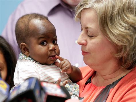 Rare Parasitic Twin Removed Surgically From Girls Back The Independent