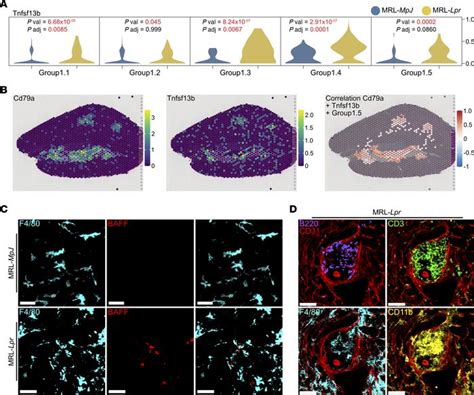 JCI Insight Distinct Pathogenic Roles For Resident And Monocyte Derived Macrophages In Lupus