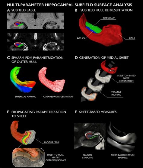 The Spectrum Of Structural And Functional Imaging Abnormalities In