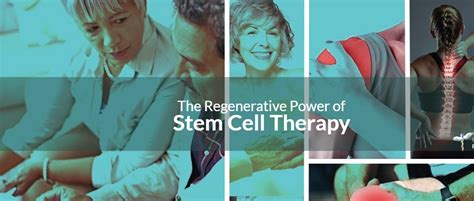 Holistic Bio Spa On Linkedin Exosomes Exosomestherapy
