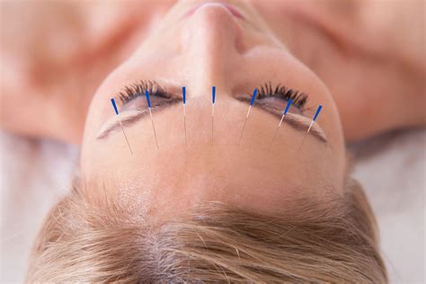 Acupuncture Depression Boston Acupuncture For Stress And Depression