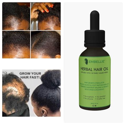 Herbal Hair Growth Oil