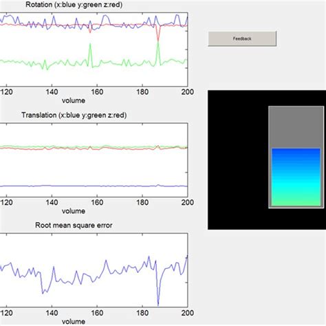 Snapshot Of A Frontend Designed With The Matlab® Guide Tool Showing Download Scientific