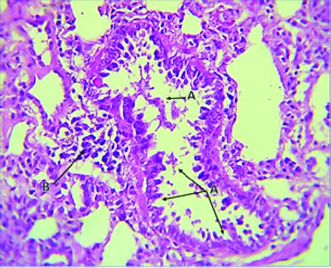 Lung Section Of A Rat From The Group Treated With Cadmium Chloride And Download Scientific