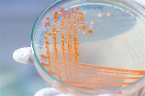 Serratia Marcescens 가족 Enterobacteriaceae 미생물학 실험실에에서 막대 모양의 그람 음성 세균의