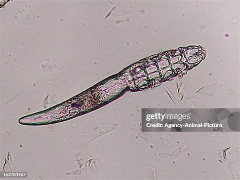 44 Demodex Stock Photos, High-Res Pictures, and Images - Getty Images