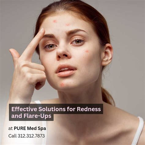 Effective Solutions For Redness And Flare Ups At Chicago Pure Medical Spa Effective Solutions For Redness And Flare Ups At Chicago Pure Medical Spa