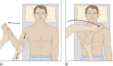 Shoulder Dislocation Anesthesia Key