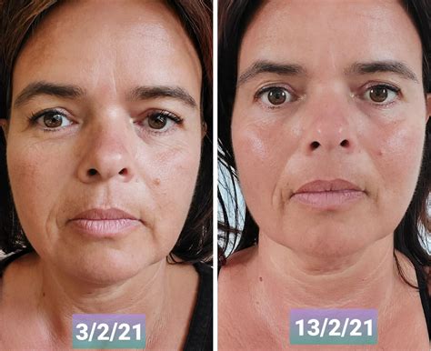 Yoga Before And After Results